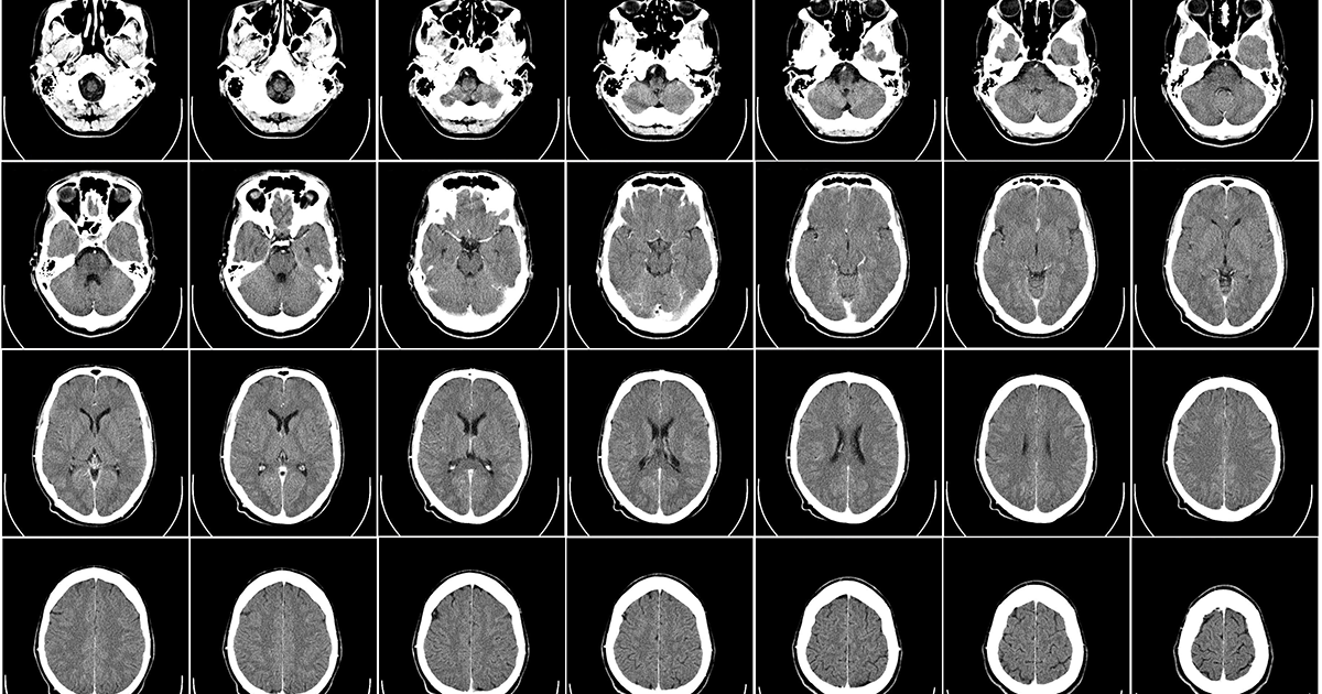 Belief and the Brain Part 1: Is the Human Mind Unique?